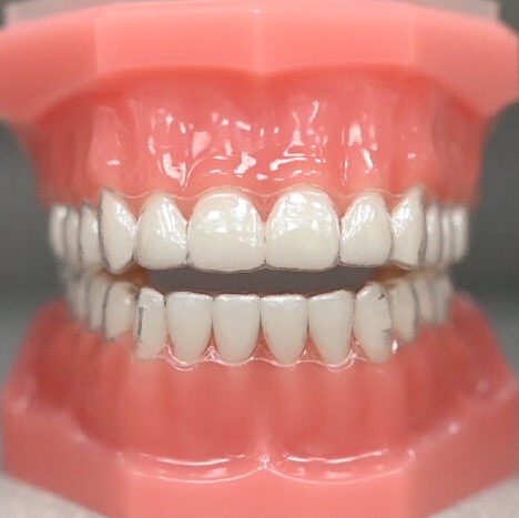 Aligners Kenner LA, Lakeside Dental Care